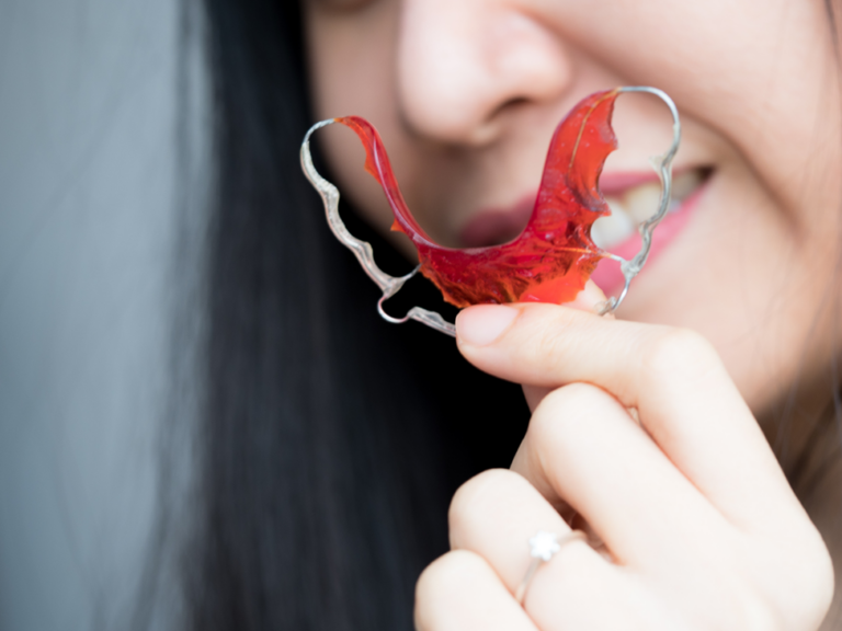 Tips for Caring for Your Retainer | Ludlow Orthodontics